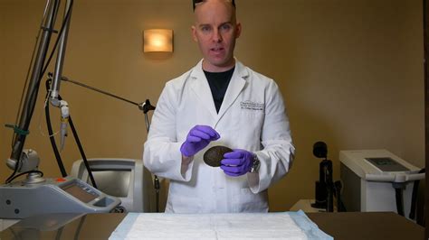 Pearly Penile Papules Removal In Canada 4k Youtube