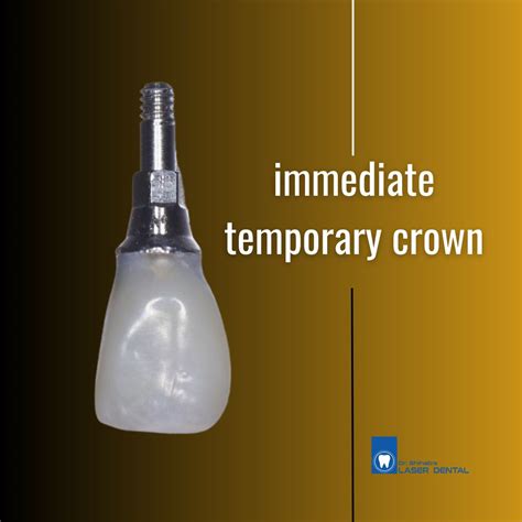 Shihabur Rahman On Linkedin Temporarycrown Dentalimplant