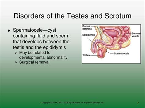 Reproductive System Disorders Ppt Download