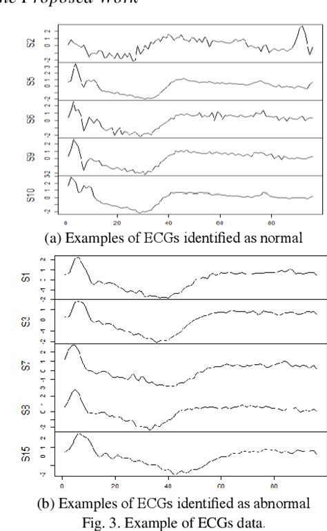 Figure 1 From Deep Autoencoder Networks Optimized With Genetic