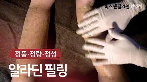 바디 관리 시작 팔 알라딘필링 시술 영상 톡스앤필 안양점 Youtube