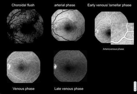 Radiology Lecture 13 Angiography Flashcards Quizlet