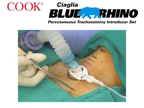 Percutaneous Tracheostomy Ppt