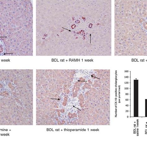 Measurement Of The Number Of Pcna Positive Cholangiocytes In Liver Download Scientific Diagram