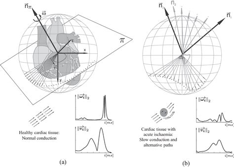 Cardiac Vector At Collection Of Cardiac Vector Free For Personal Use