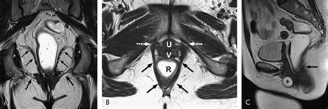 Magnetic Resonance Imaging Of Pelvic Floor Disorders Topics In