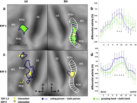 A C Statistical Parametric Maps Spms Showing In Color The Voxels Download Scientific