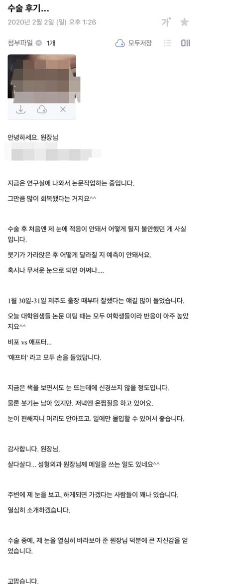 연세이앤비성형외과 안녕하세요♥️😍 연세이앤비성형외과입니다 저희 병원에서 수술하신 환자분께서 메일로 수술후기를 보내주셨습니다수술 후 만족하셔서 저희도 너무 기쁩니다🎶🤩