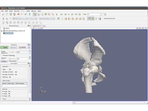 3d Print Your Medical Scan Make