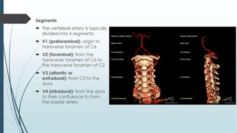 Craniovertebral Junction Ppt Download