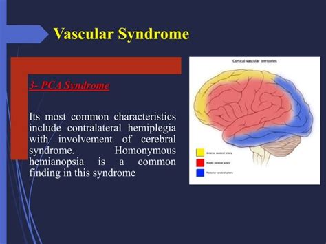 Stroke Cva Cva Cerebrovascular Accident Transient Ischemic Attack Ppt