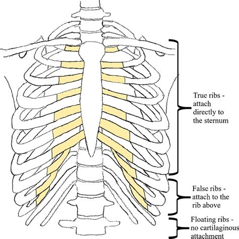 Diagram Of Normal Rib Anatomy Showing The True False And Floating