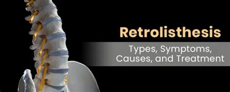 Retrolisthesis Types Symptoms Causes And Treatment