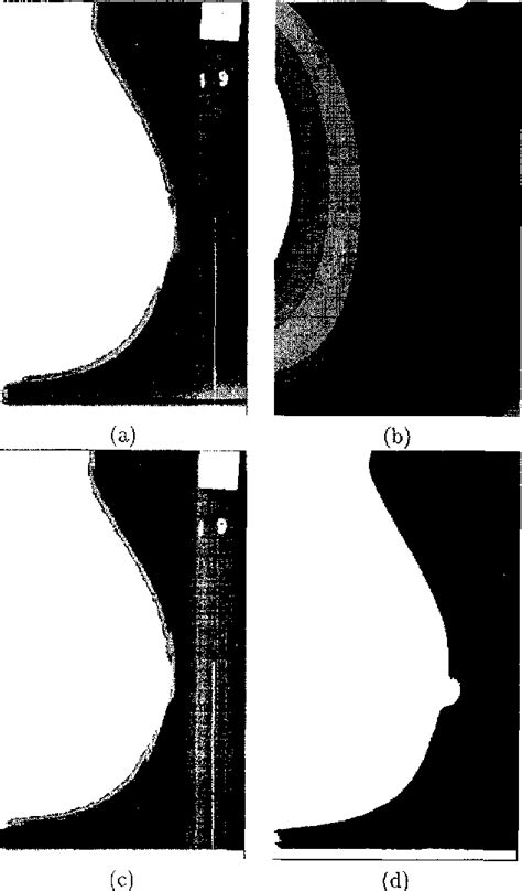 Figure 1 From Gross Segmentation Of Mammograms Using A Polynomial Model Semantic Scholar