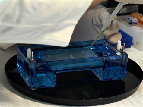 Video Dna Vector Based Rna Interference To Study Gene Function In Cancer