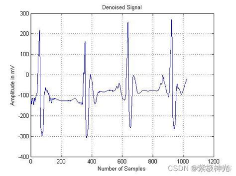 【脑电信号】基于matlab小波变换dwt脑电信号ecg去噪【含matlab源码 1622期】wx610cd8661bd33的技术博客
