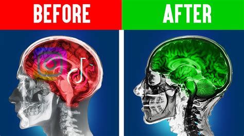 What Brain Rot Is Doing To You You Must Keep Your Brain Healthy Youtube