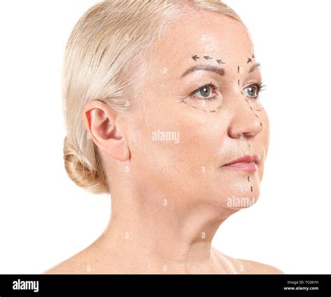 Mature Woman With Marks On Her Face Against White Background Concept Of Plastic Surgery Stock