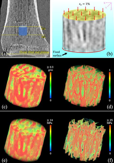 Finite Element Analysis Of Trabecular Bone Microstructure Using Ct