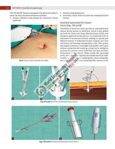 Laparoscopic Port Closure Technique Pdf