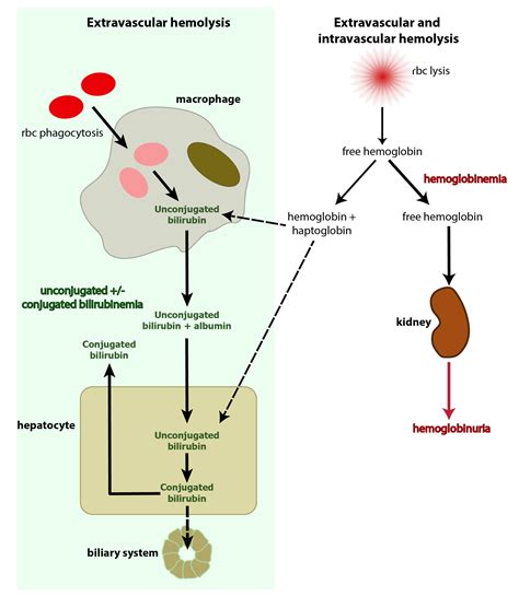 Bilirubin And Hemolytic Anemia Eclinpath