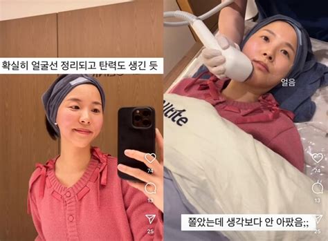 요즘 Hot 나는솔로 순자 올타이트 리프팅 효과 가격 후기 유지기간 주의사항 여신티켓 시술백과