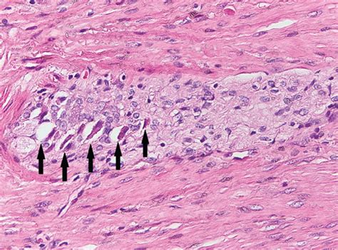 Representative Photomicrographs Illustrating Signs Of Myenteric Download Scientific Diagram