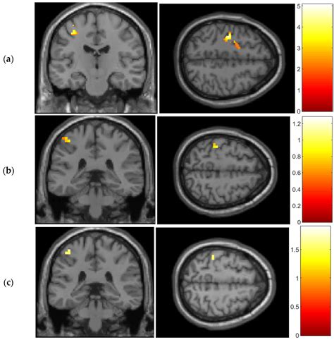 Applied Sciences Free Full Text Diffuse Optical Tomography Provides