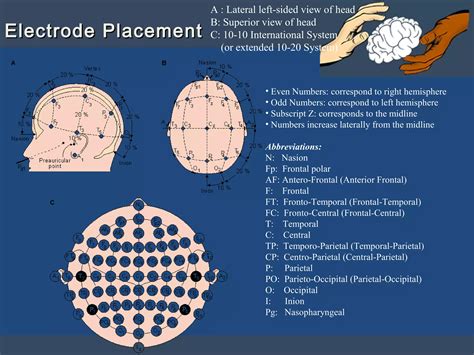 Neuro Physiology Of Seizures And Eeg Pedaitric Neurologist Dr Amit