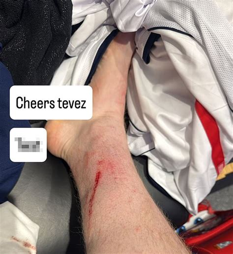 Soccer Aid Row Erupts After Horror Challenge Leaves Celebrity With Severe Cut As Carlos Tevez Is