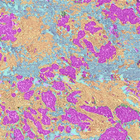 GitHub Deepathology Fseg Unsupervised Semantic Segmentation For Pathology