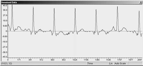 Denoising Of Ecg Signal Using Daubechies Wavelet Daubechies Db4 Wavelet Download Scientific