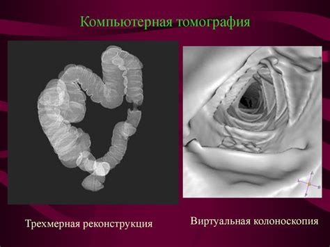 Лучевая диагностика заболеваний органов желудочно-кишечного тракта ...