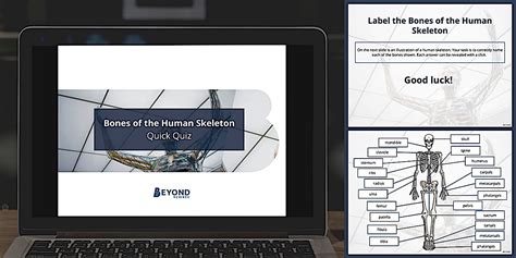 Bones Of The Human Skeleton Quick Quiz Teacher Made