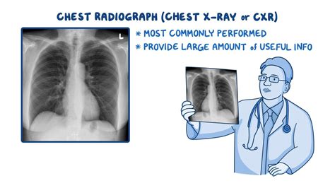 Video Chest X Ray Interpretation Clinical Sciences Osmosis