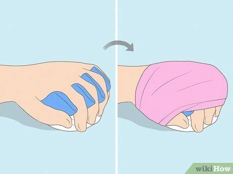 How To Apply Splints Makeshift And Medical Splint Tutorials