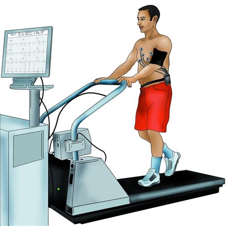 Exercise Stress Test Treadmill Or Bike Stress Test British Heart