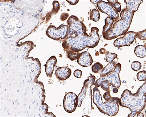 Sms Recombinant Monoclonal Antibody Je61 85 Ma5 44855