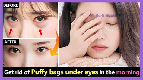Only 2 Mins How To Get Rid Of Puffy Bags Under Eyes And Swollen Under Eyes In The Morning