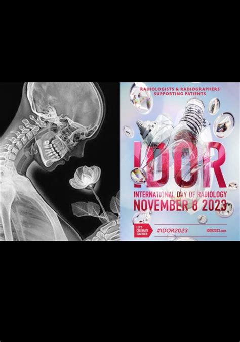 Mohammad Alhaddad On Linkedin Happy International Day Of Radiology 🎉