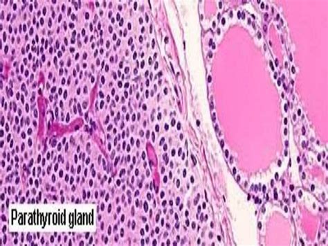 Hyperparathyroidism Pdf Thyroid Disorders Endocrine And Metabolic Diseases