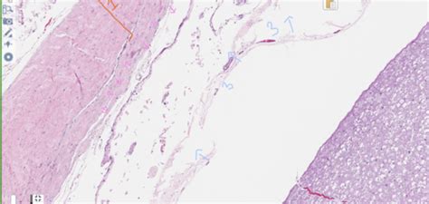 Midterm Nervous And Digestive System Identification Flashcards Quizlet