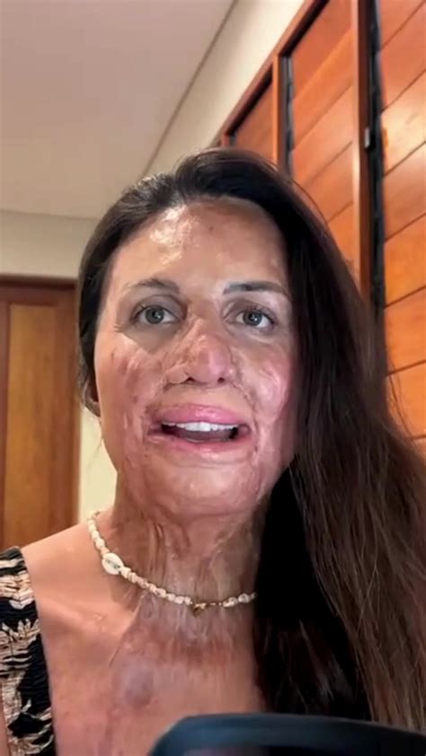 Many Of You May Be Aware Of Turia Pitts Amazing Story Of Survival