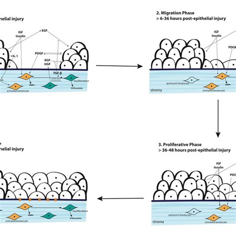 Stepwise Approach For The Management Of Persistent Corneal Epithelial Download Scientific