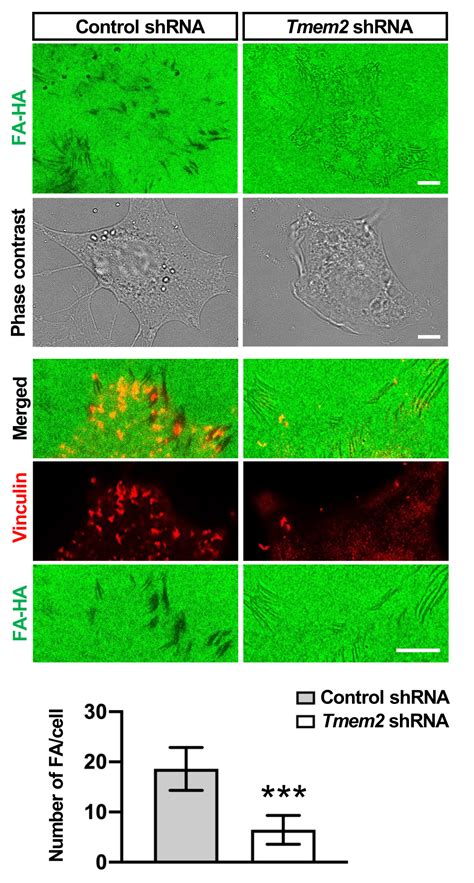 In Vitro Investigation Of The Effects Of The Hyaluronan Rich Extracellular Matrix On Neural