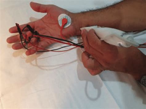 Arrangement Of The Recording Electrodes And The Stimulator For The Download Scientific Diagram