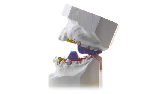 Twin Block Ortho Lab