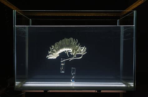 Corpus Callosum Ani Liu