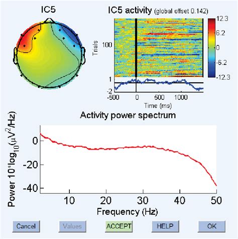 Figure 6 From Towards Human Brain Signal Preprocessing And Artifact
