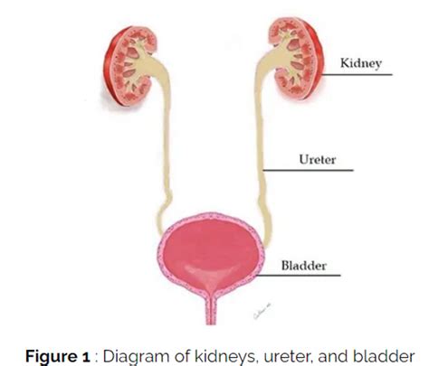 Shock Wave Lithotripsy